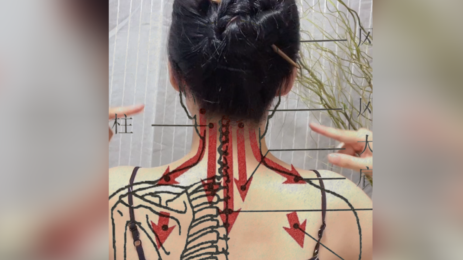 Relieving Stiff Neck and Neck Pain with Gua Sha Technique – TanmuCare